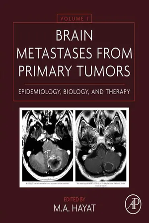 Pdf Brain Metastases From Primary Tumors Volume 1 By M A Hayat