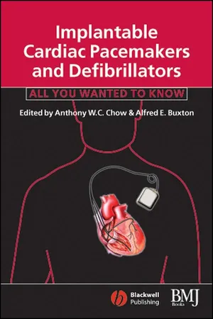 [PDF] Implantable Cardiac Pacemakers and Defibrillators by Anthony W C ...