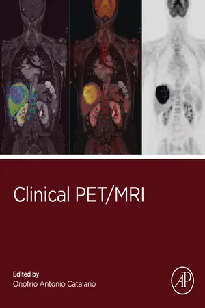 [PDF] Clinical PET/MRI by Onofrio Antonio Catalano | 9780323885379 ...